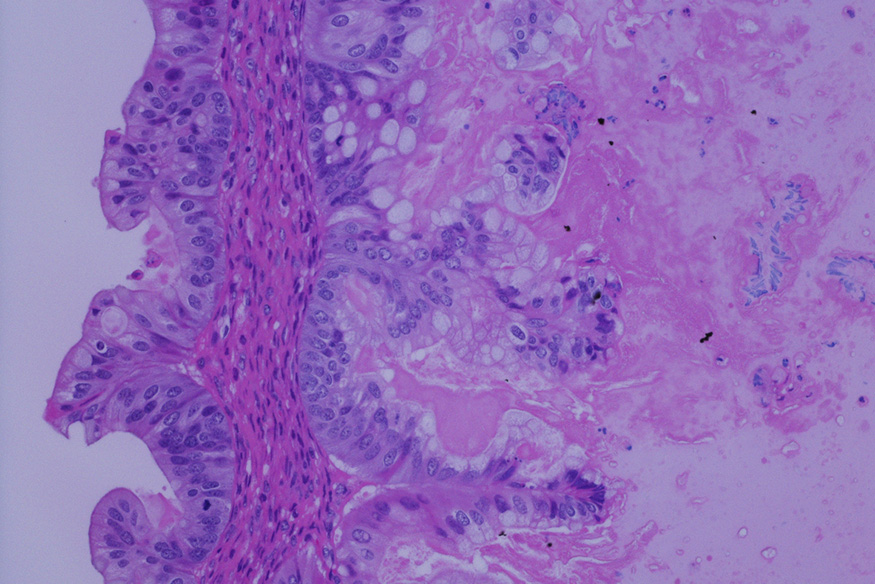 News Center | VCU Massey Comprehensive Cancer Center